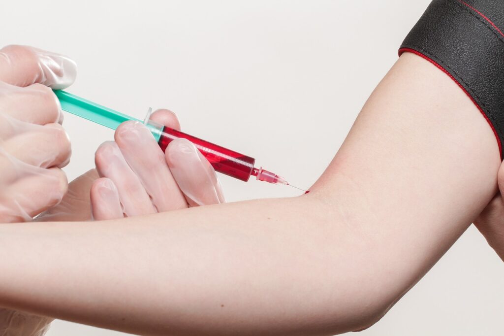 Come prepararsi per un prelievo di sangue - Switchovermedia.it Come prepararsi per un prelievo di sangue - Switchovermedia.it